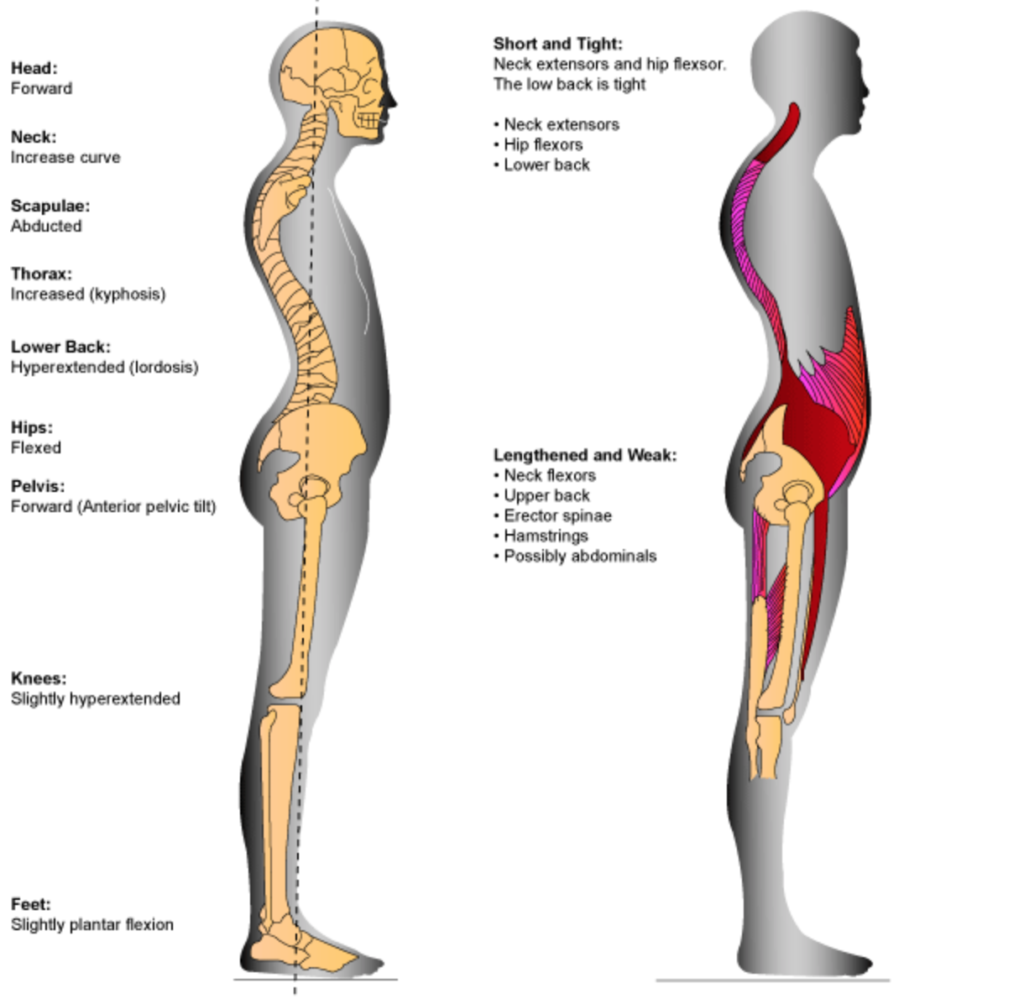 Pourquoi la posture est-elle aussi fondamentale dans votre progression ...