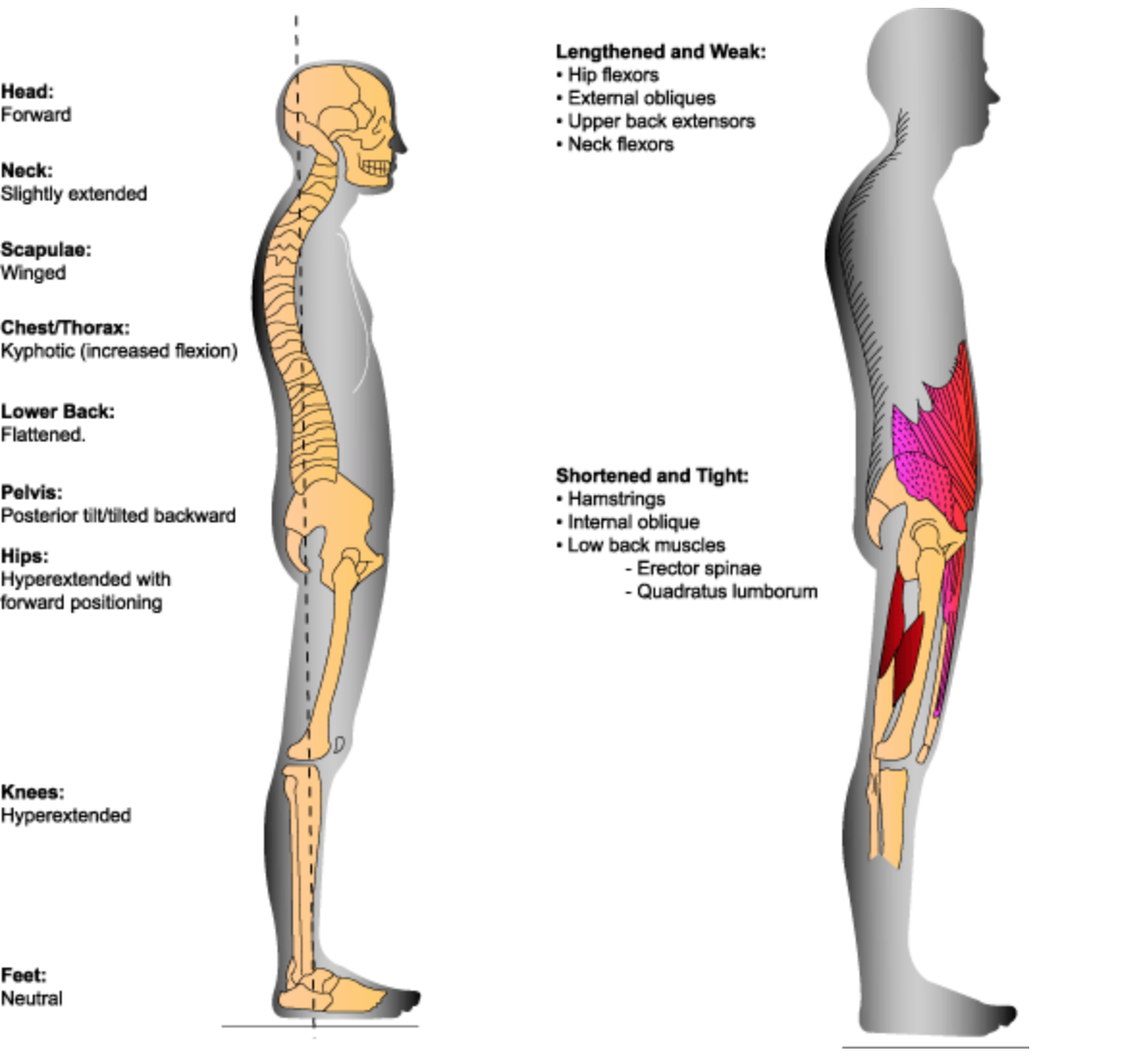 Pourquoi la posture est-elle aussi fondamentale dans votre progression ...